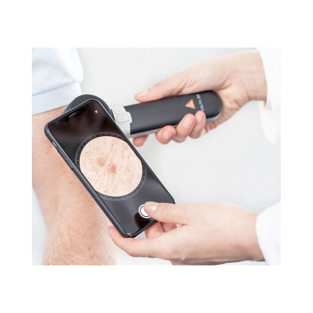 HEINE DELTA 30 Dermatoscope with table charging station
