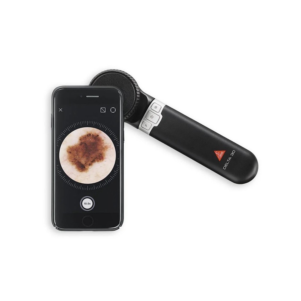HEINE DELTA 30 Dermatoscope with table charging station